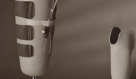 Advancing Custom Automated Prosthetics with PEEK Kunststoff: A ...
